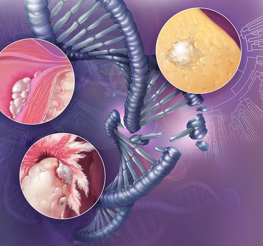 Hereditary Cancers in Gynaecology